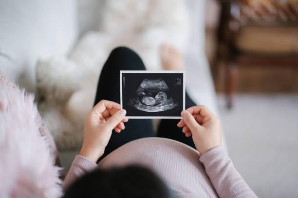 Start da Fertilidade: Tudo o Que Você Precisa Saber